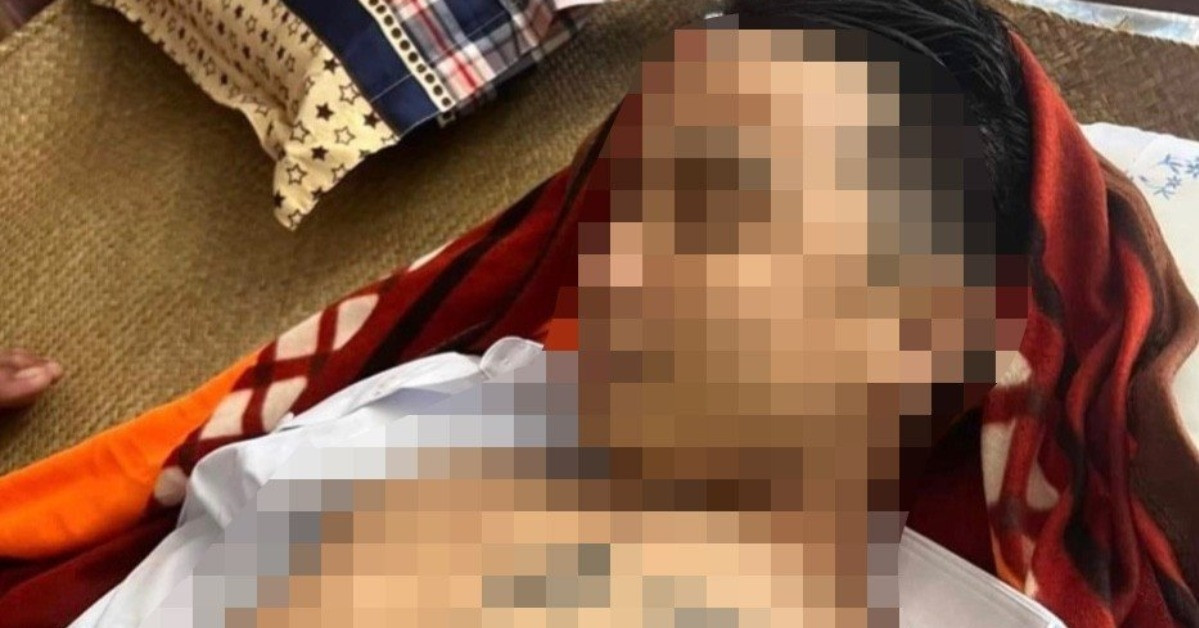 Điều tra vụ thanh niên tử vong, ngực bị thủng một lỗ ở Long An