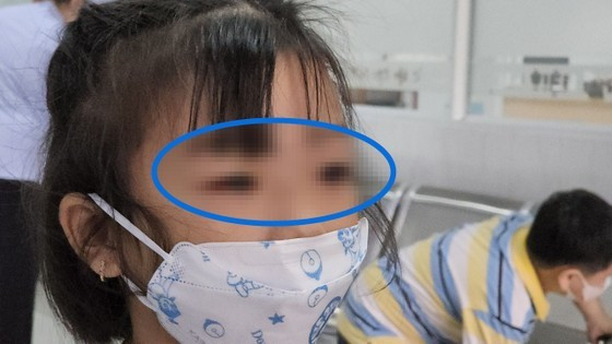 Enterovirus, adenovirus identified as cause of pink eye in HCM City