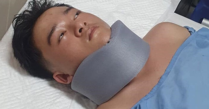 Mẹ tâm thần chẳng hay biết con trai mê man do mắc bệnh não hiếm gặp